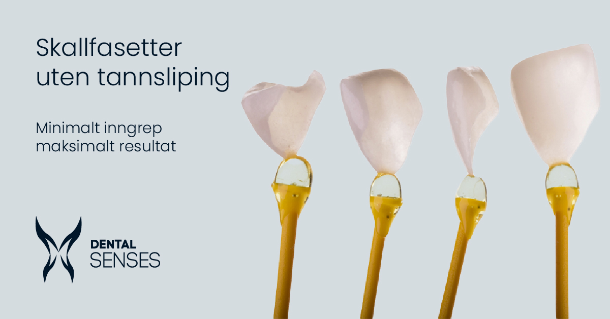 Skallfasetter uten tannsliping • Dental Senses Oslo